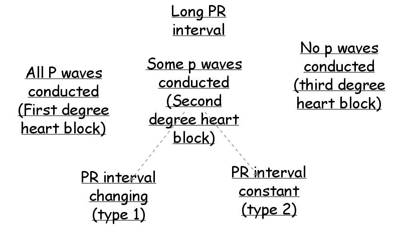 ECG: Long PR interval | Insight Maker