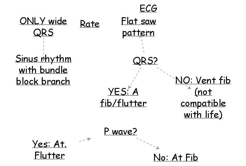 ECG Flow chart | Insight Maker